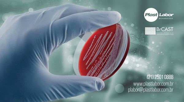 Plast Labor adota o BrCast em sua linha de produção - Laes&Haes